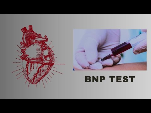How BNP Test is done to monitor Heart Condition?