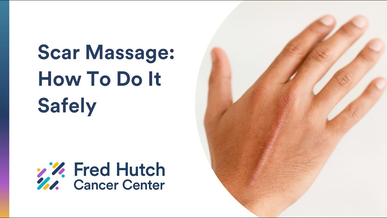 Scar Massage: How to do it safely