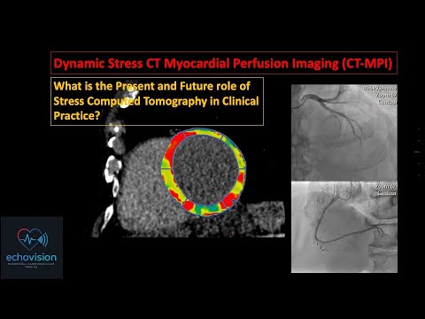 Dynamic Stress CT Myocardial Perfusion Imaging (CT MPI)