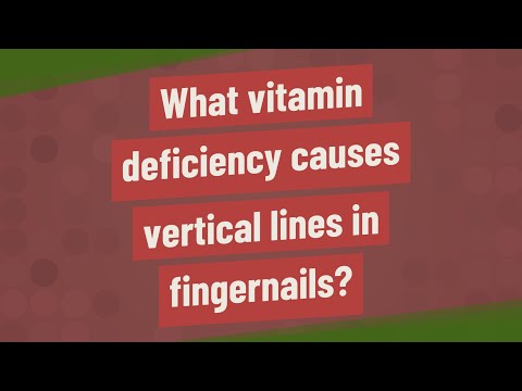 What vitamin deficiency causes vertical lines in fingernails?