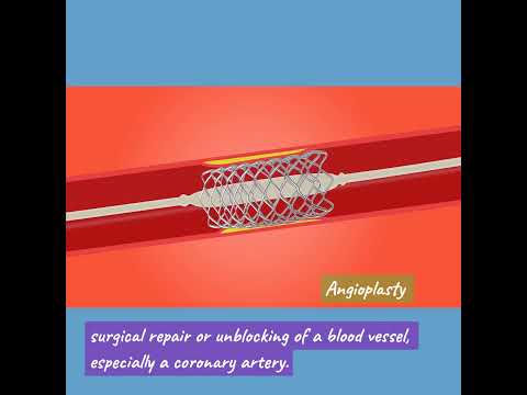 Angioplasty: surgical repair of a blood vessel.