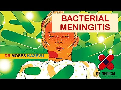 Bacterial Meningitis