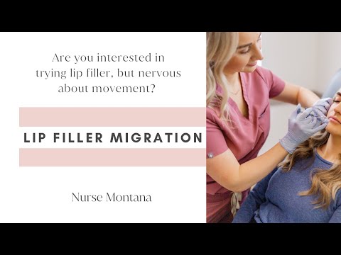 WATCH THIS before getting your lips filled ๐๐ โWhat is migration?โ
