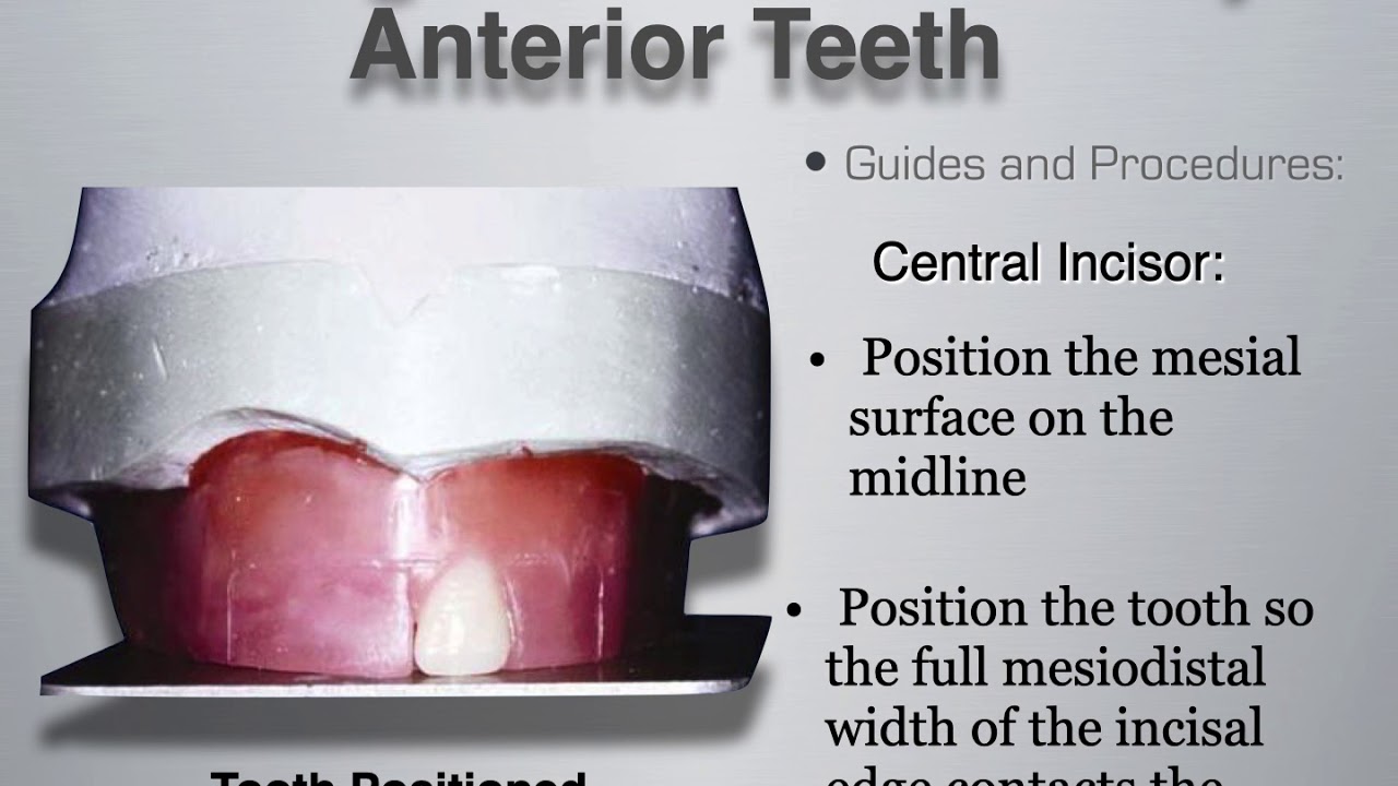 Complete Dentures 1 - 8) Anterior setup