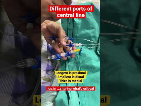#icushort 11: Different ports in central line in icu