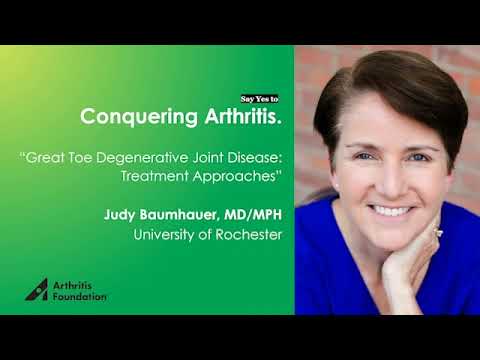 TREATMENT OPTIONS for GREAT TOE DEGENERATIVE JOINT DISEASE with Judy Bauhauer | OACS 2021