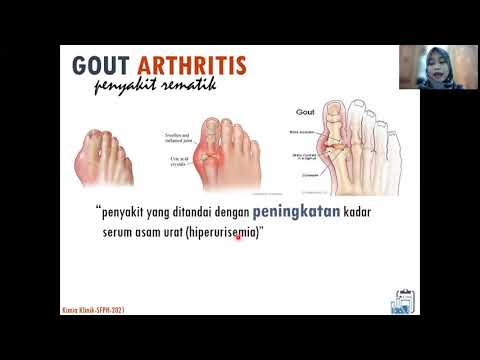 ARTHRITIS DAN METODE ANALISIS ASAM URAT