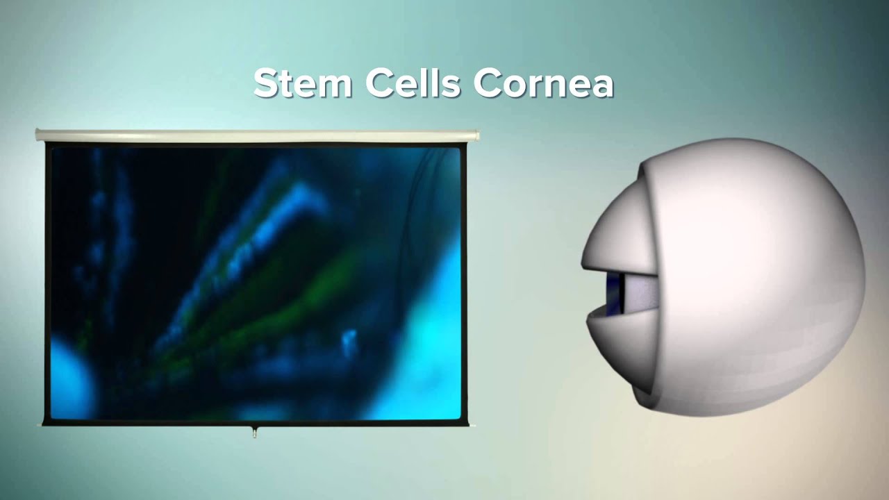 Stem cells for restoring sight