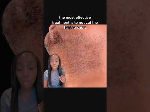 Razor bumps explained by a Dermatologist