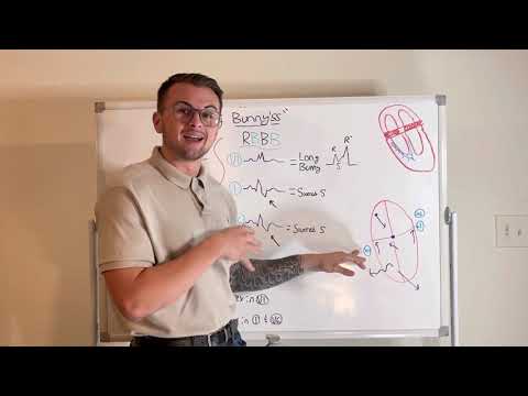 EKG Series: How to Determine a Right Bundle Branch Block (RBBB = Long Bunny’SS)