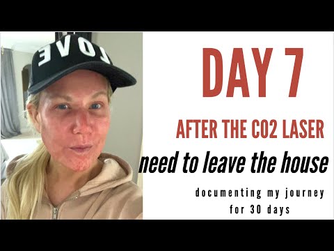 DAY 7- C02 laser post procedure. I need to get out of my house!!!!!!