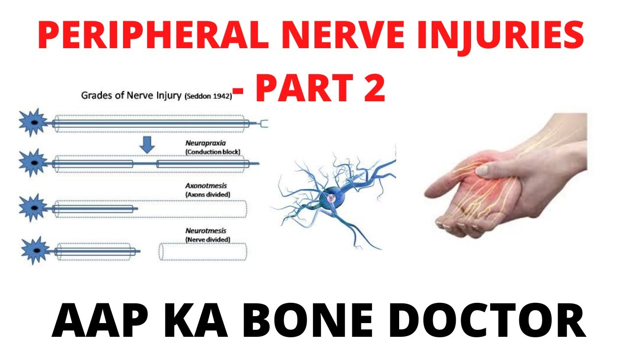 PERIPHERAL NERVE INJURIES - PART 2 - EPISODE 2