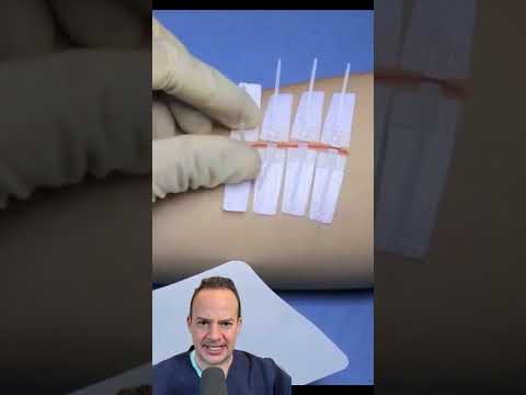 AMAZING WAY TO FIX A CUT WITHOUT STITCHES!😱 #shorts