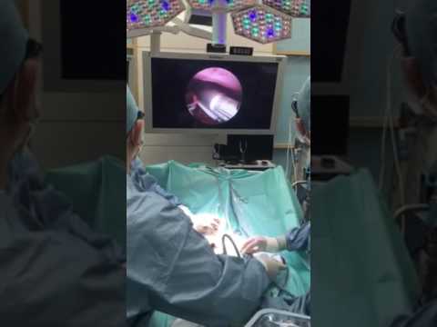 PRAA Vascular ring anomaly in 8 weeks old puppy French bull dog