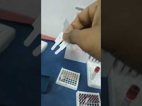 How to perform EIA ( ENZYME IMMUNO ASSAY ) manually .
