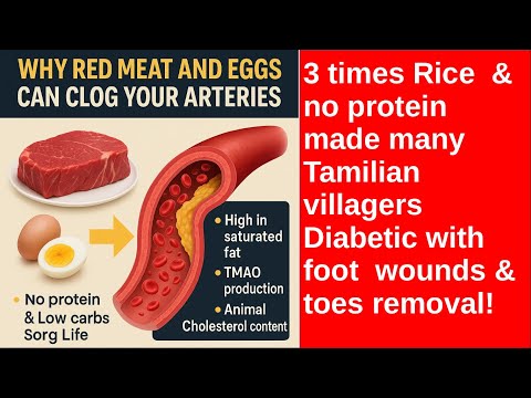 Do not get Heart attack or become sugar patient with toes removed and death. Food to take explained.