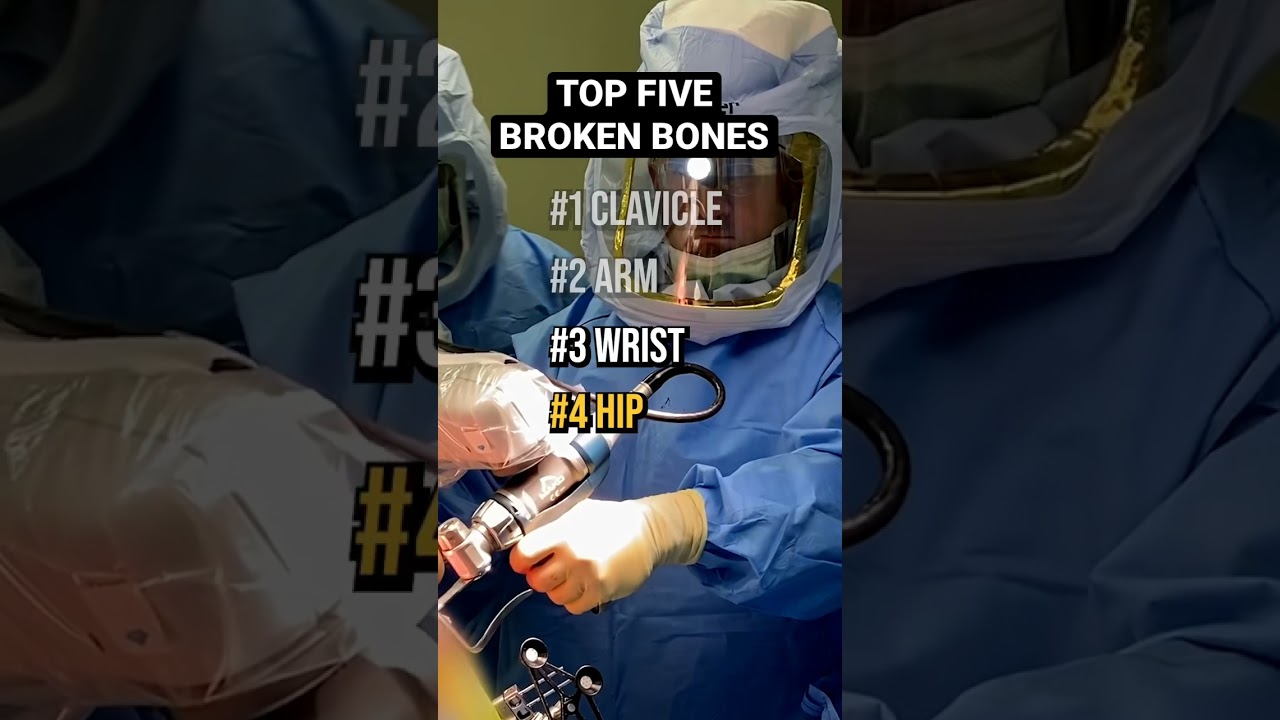 Most Common Broken Bones #fracture #orthopedics #injury #surgeonlife