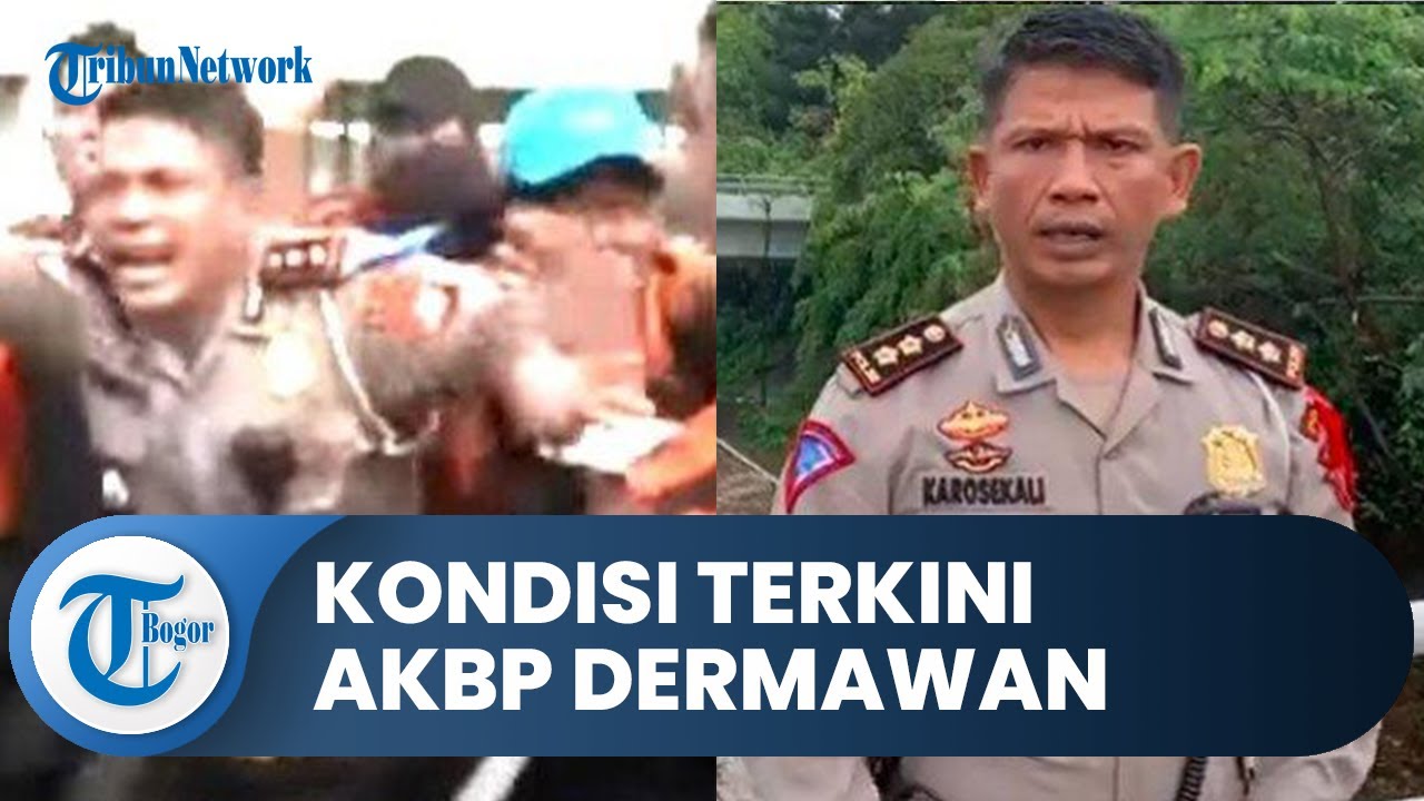 Kondisi Terkini AKBP Dermawan yang Alami Hematoma Pasca Dikeroyok Ormas Pemuda Pancasila (PP ...