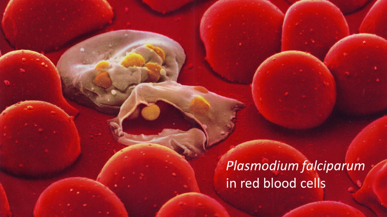Scaling up Data Intensive Bioinformatics to Attack Malaria Parasites