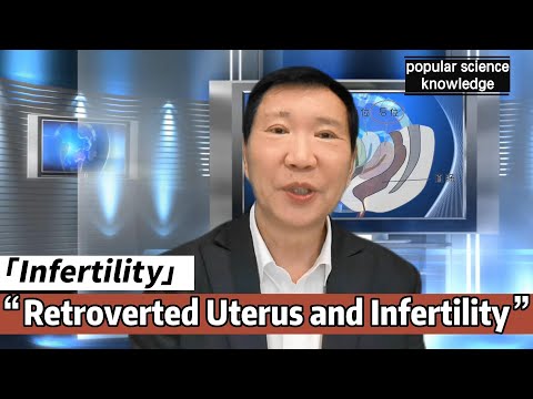 The Retroverted Uterus and Infertility- Antai Hospitals