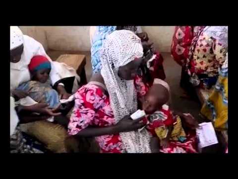 Malnutrition in Nigeria According to United Nations Children’s Fund (UNICEF)
