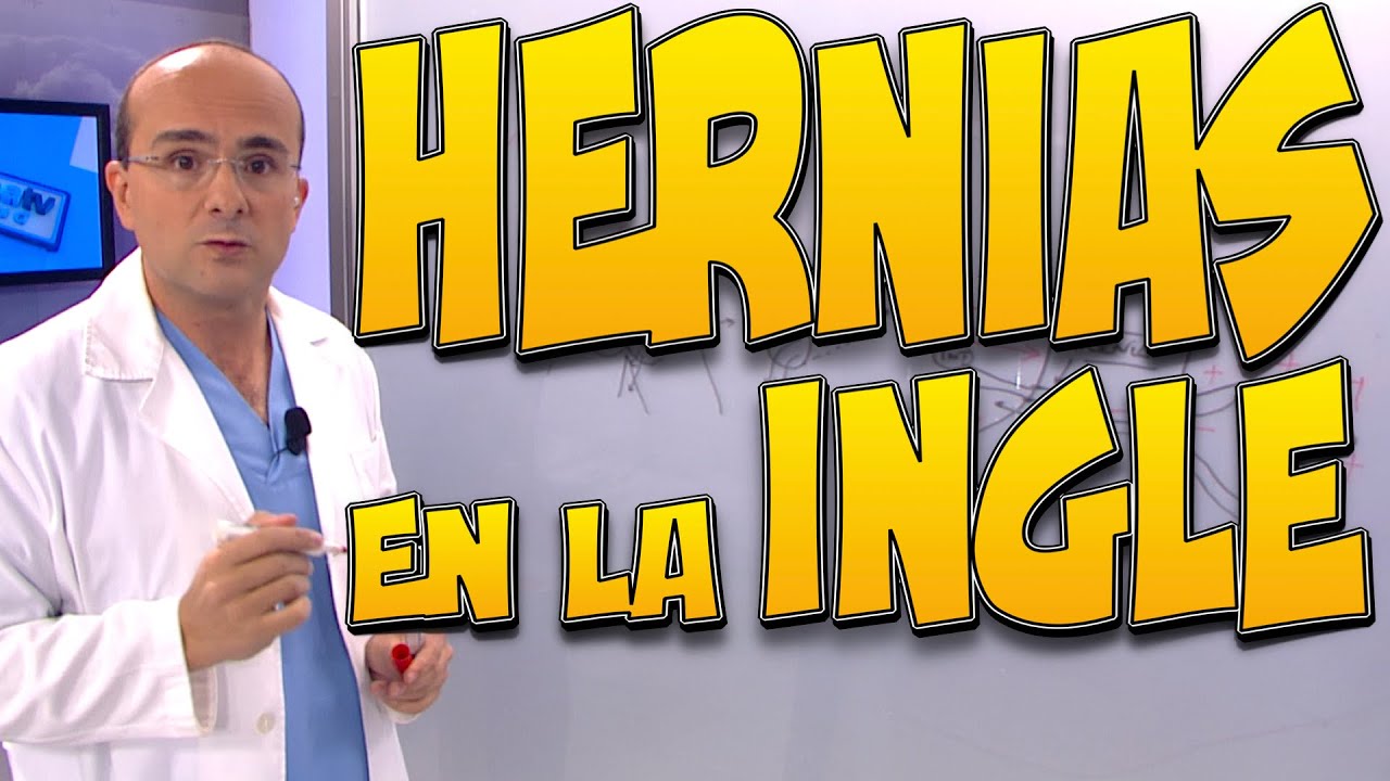 Inguinal hernias: what they are, how they form, how they are diagnosed, and what their treatment is.
