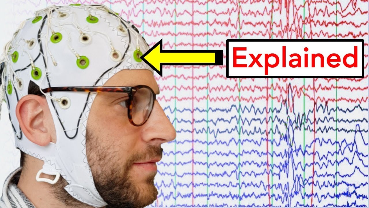 EEG (Electroencephalogram) Explained