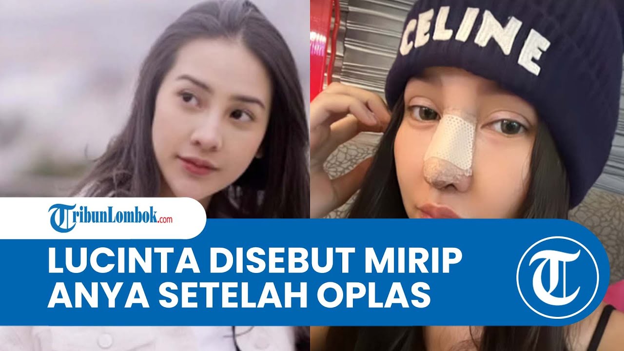 Lucinta Luna Pamer Wajah Barunya seusai Operasi Plastik di Thailand ...