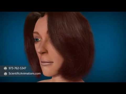 Dental Crown Procedure | Dental Animation