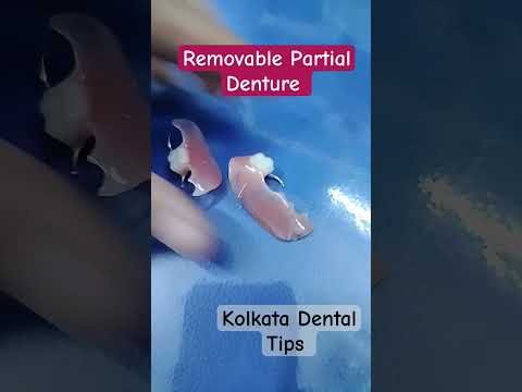 Removable Partial Denture (RPD) #dental #dentalcare #westbengal