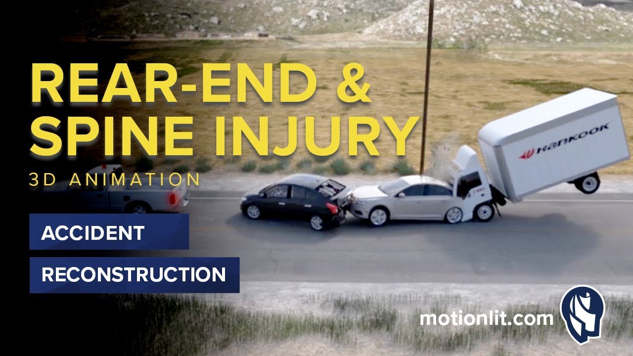 Rear-End and Spine Injury Accident Reconstruction Animation