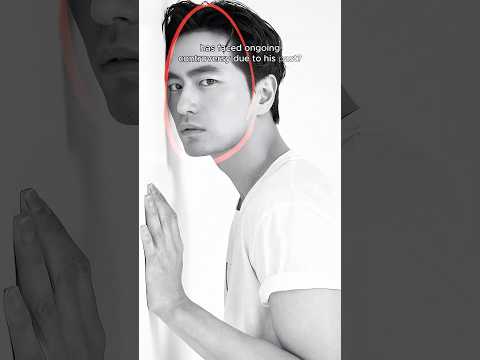 Problem with Squid Game 2 Cast | Lee Jin-wook Intimate Scandal #squidgame2