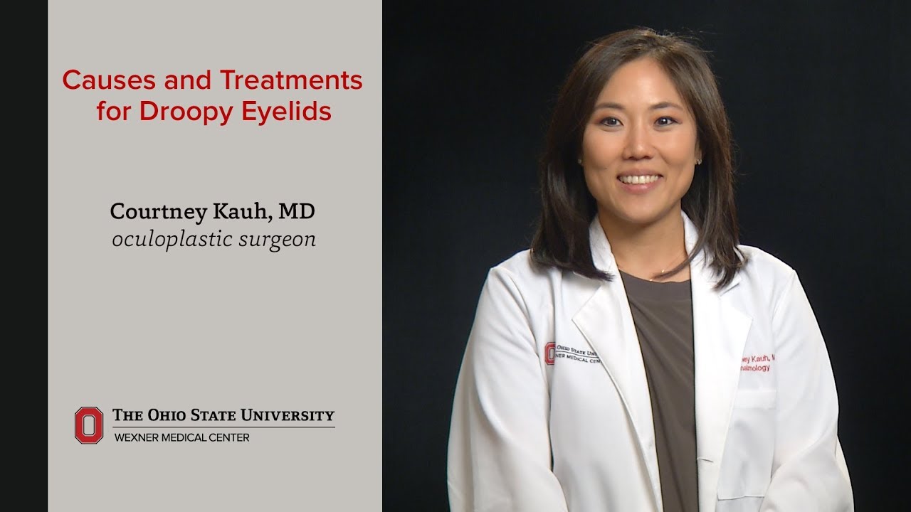 Droopy eyelid causes and treatments | Ohio State Medical Center