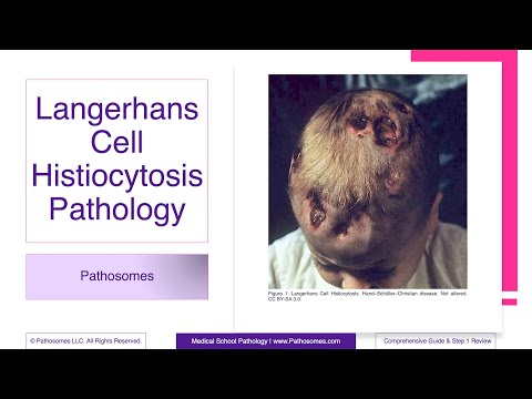 Langerhans Cell Histiocytosis Pathology | Comprehensive Guide & Step 1 Review | Pathology Step 1
