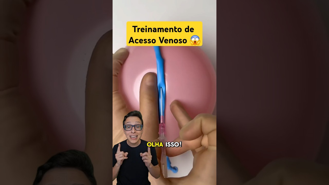 Desafio de Acesso Venoso 😱#medicina #medico #enfermagem #enfermeiro #enfermeira Acesso Periférico