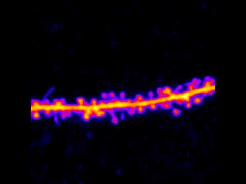 dendritic spines and filopodia