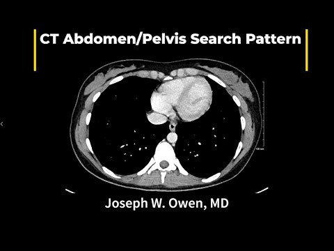 A Basic Search Pattern for Reading CT of the Abdomen and Pelvis