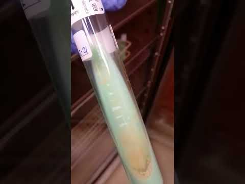 Mycobacterium tuberculosis (TB) on LJ agar - Microbiology