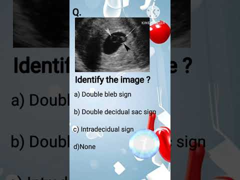 Image based questions: Obgy #medico #obgy #radiology #pregnancy #questions