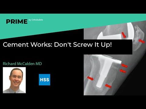 Cement Works: Don't Screw It Up! - Richard McCalden MD