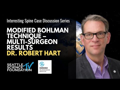 Modified Bohlman Technique: Multi-Surgeon Results - Robert Hart, M.D.
