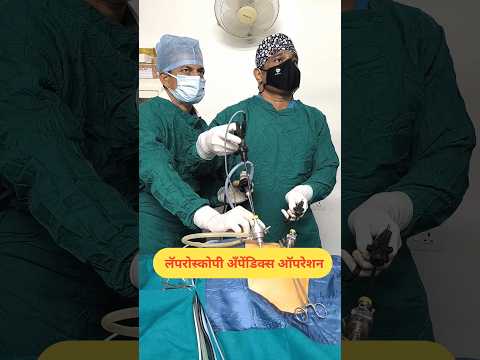 लॅप्रोस्कोपी अपेंडिक्स सर्जरी कशी होते? #shorts