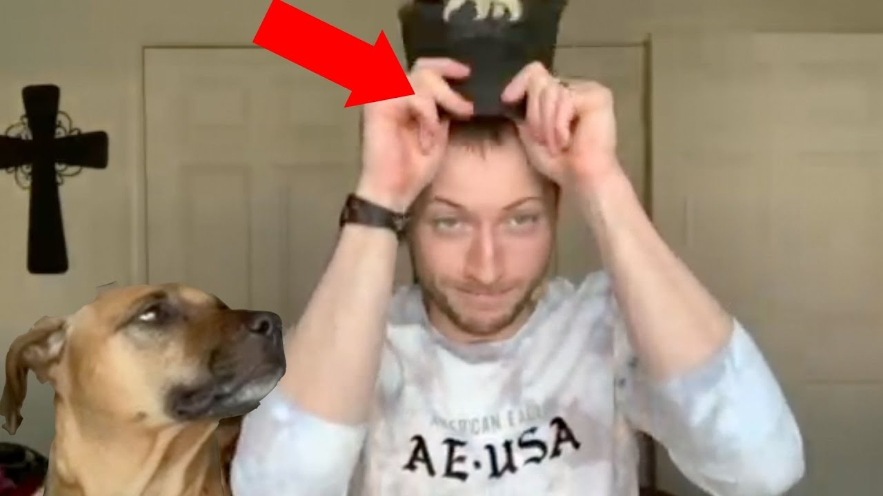 BALDING Man Tired Of Hiding What's Under His Hat