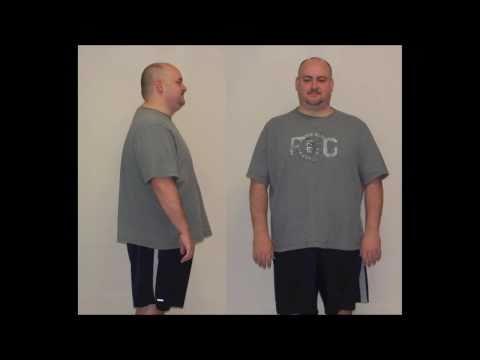 120 lbs gone in 10 months with the Gastric Sleeve | Weight Loss Surgery