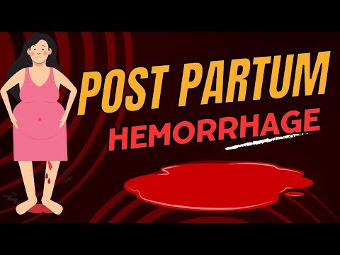 Post Partum Hemorrhage ( PPH) | Risk Factors, Causes and Management