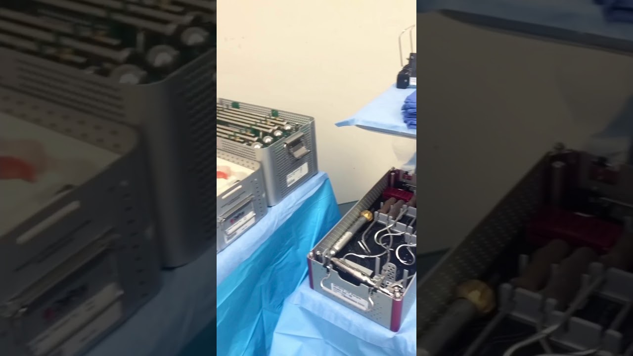 Revision Hip Replacement Surgery Setup
