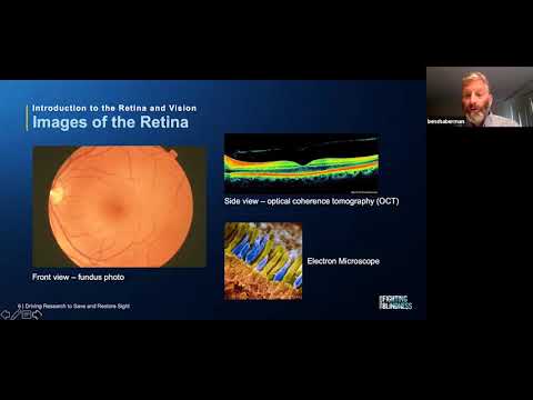 An Eye on Education: Introduction to the Eye, Retina & Vision