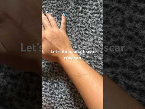 Wrap Around Vine Tattoo: scar coverup #tattoo #tattoocoverup #scarcoveruptattoo #tattooartist