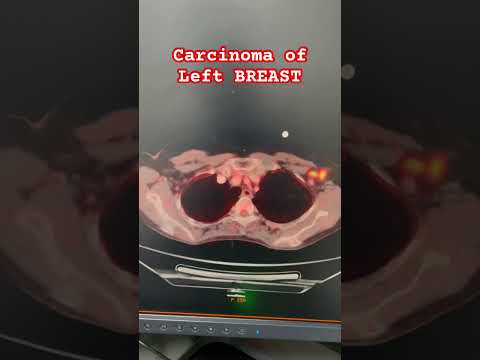 Radiographer #ytshorts #yt #youtubeshorts #youtube #trending #trendingshorts #radiology #ctscan #ai