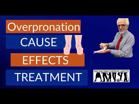 Overpronation: Causes, Effects, and Treatment | Foot and Ankle Center ...